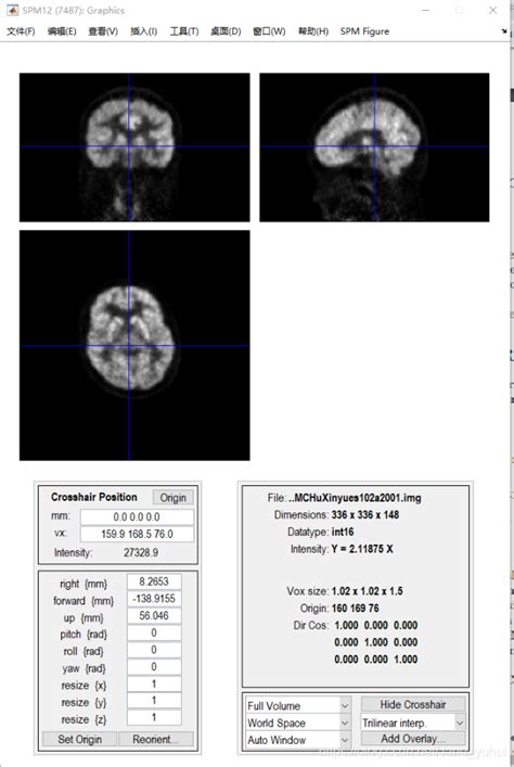 spm12 入门教程 spm12入门教程 csdn博客