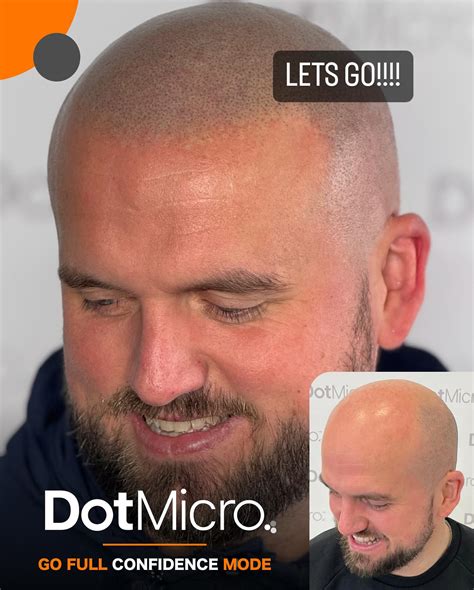 Dot Micro Dot Micro Added A New Photo