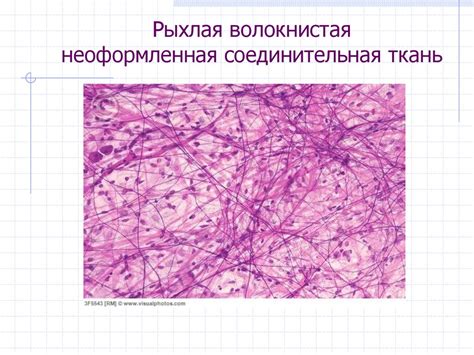 Cоединительные ткани Ii презентация онлайн