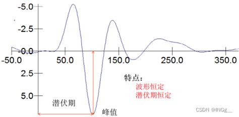 【eeg信号处理】erp相关erp事件相关电位 Csdn博客