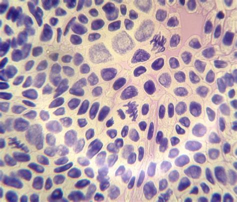 Innovating Science Small Group Learning Dnachromosome Staining