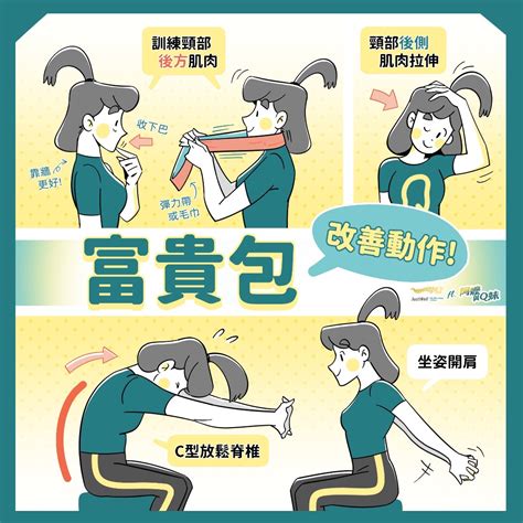 聊療Bar脖子後方腫一包竟是富貴包嚴重恐引發胸悶心悸 3 動作有效緩解 文章 運動筆記