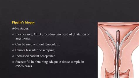 Approach To Post Menopausal Bleeding PPTX