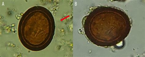 Echinococcus Granulosus Egg