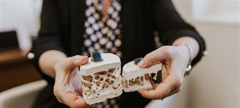 Physiotherapy In Treating Rheumatology Conditions Physiomotion London