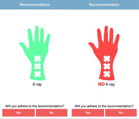 Amsterdam Pediatric Wrist Rules Mobile Application Recommendation