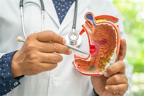 Docteur En Maladies De Lestomac Avec Un Modèle Danatomie Pour Le