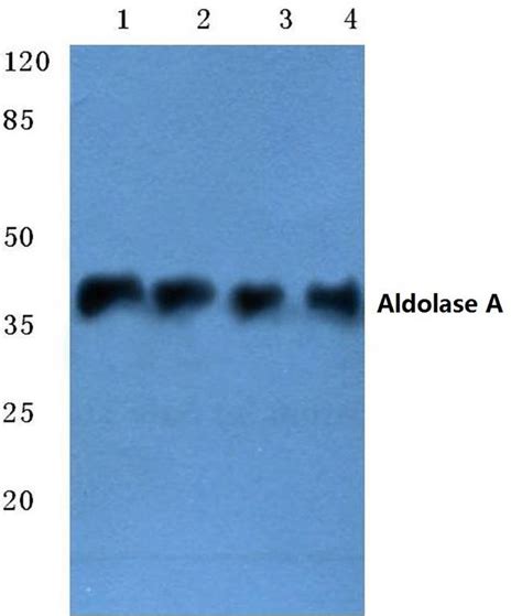 Aldolase A Polyclonal Antibody Pa5 86372