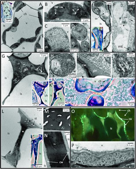 Evolution Of Cellular And Subcellular Traits In Hr Like Lesions Within Download Scientific