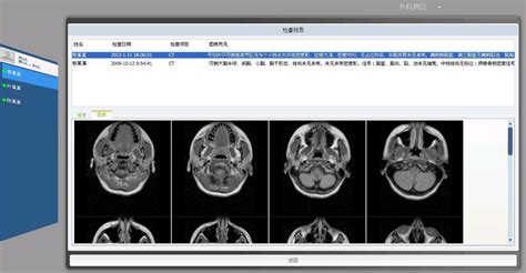 尚医云医学影像临床信息系统 Q医疗 医疗信息化平台