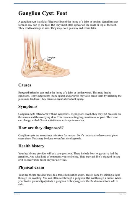 Ganglion Cyst On Foot Hotsell