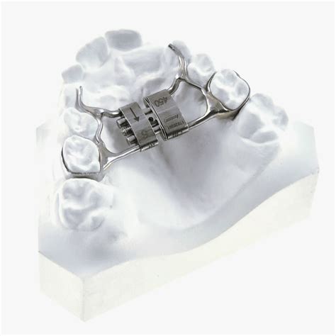 Memoria® Leaf Spring Self Activated Expander 4 And 6 Springs 33007