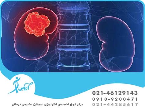 تومور ویلمز چیست راه درمان تومور ویلمز آروین کلینیک