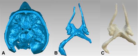 A Computational Model Of Dissected Specimen Mp1670 With The Optic