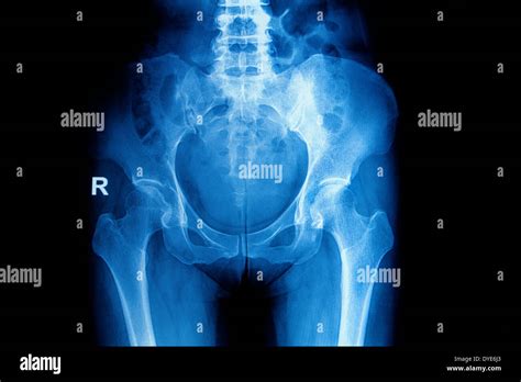Anatomy Female Pelvis Fotos Und Bildmaterial In Hoher Auflösung Alamy