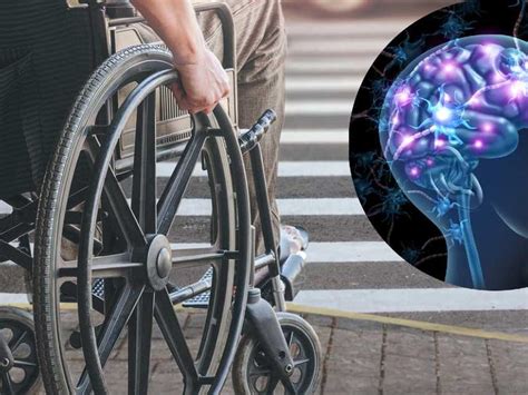 ¿qué Son Las Enfermedades Neurológicas Su Impacto En El Cuerpo Y El