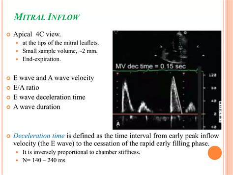 Diastolic Dysfunction 2016 Ppt