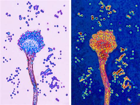 Types Of Fungal Spores
