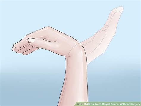 4 Ways To Treat Carpal Tunnel Without Surgery Wikihow