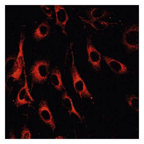 The Mitochondrial Membrane Potential Δψm In Airway Smooth Muscle Cells