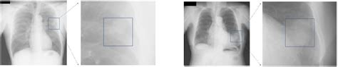 Figure 1 From Using Deep Convolutional Neural Networks To Optimize