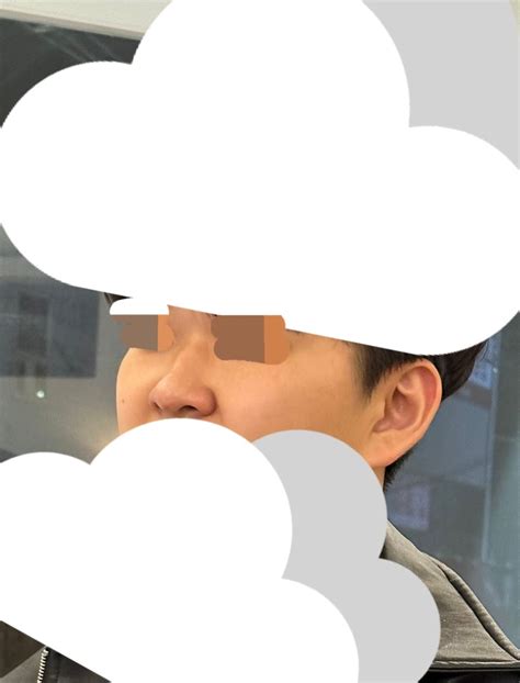 자유수다 대구 엣지성형외과에 강남언니 1등 성형수술and피부시술 정보앱