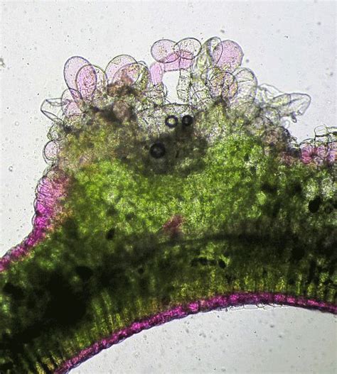 Physoderma Pulposum Plant Parasites Of Europe