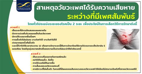 สาเหตของการทอวยวะเพศโคงงอ บทความนมคำตอบ