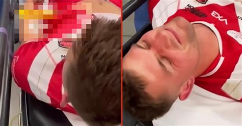Uk Rugby Lad Gets Impaled By Sideline Flagpole And Theres Footage To