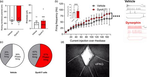 Ventrolateral Periaqueductal Gray Vlpag Neuronal Excitability Is Download Scientific Diagram