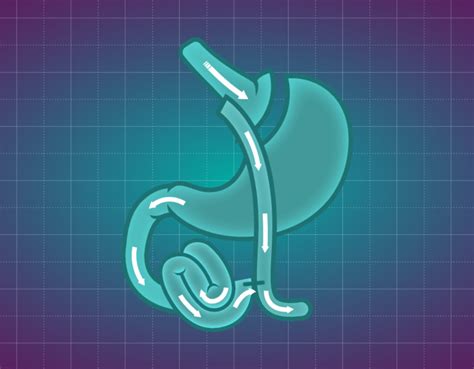 Gastric Bypass Surgery In Tijuana Mexico Limarp Clinic