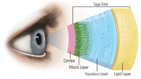 Meibomian Gland Clogged