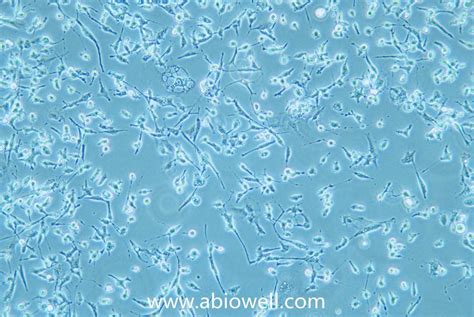 Mda Mb 436 人乳腺癌细胞（str鉴定）艾碧维生物官网