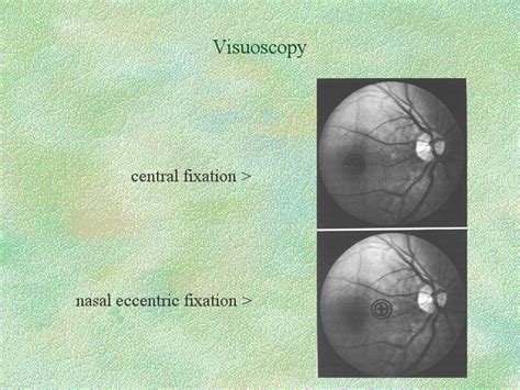 Visuoscopy