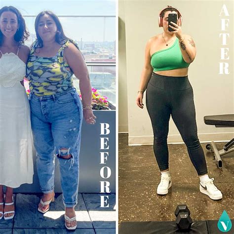 Transformative Journeys Semaglutide Before And After