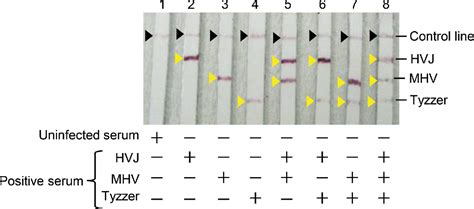 Figure 2 From Multiplex Immunochromatographic Assay For Serologic