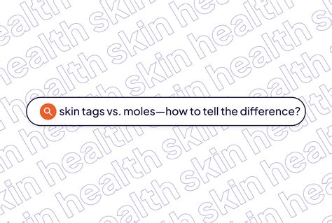 Skin Tag Vs Mole How To Tell The Difference