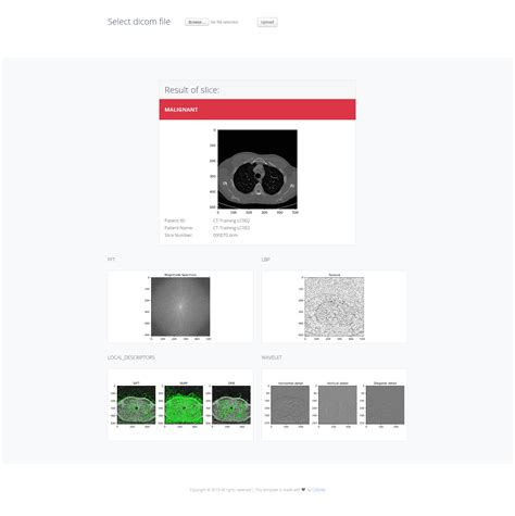 Lung Cancer Image Classification Lung Cancer Image Classification In Python Using Lidc Dataset