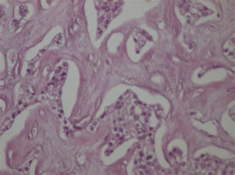 Paraffin Embedded Tissue Histological Examination Hematoxylin And