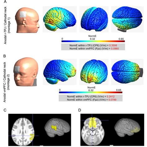 Contribution Of The Right Temporoparietal Junction And Ventromedial Prefrontal Cortex To Theory