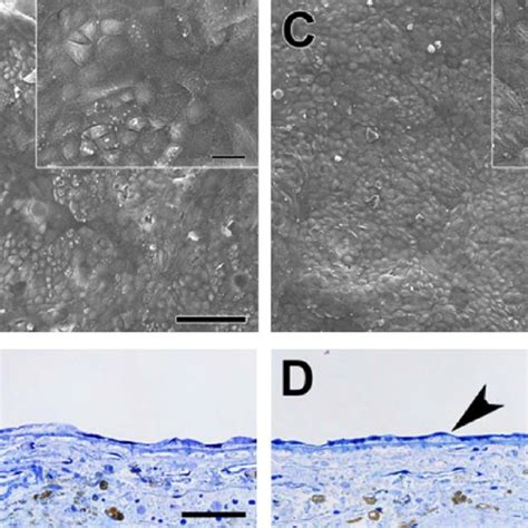 Behavior Of Fetal Rpe On Bruchs Membrane After Freezethaw And Cm Download Scientific Diagram