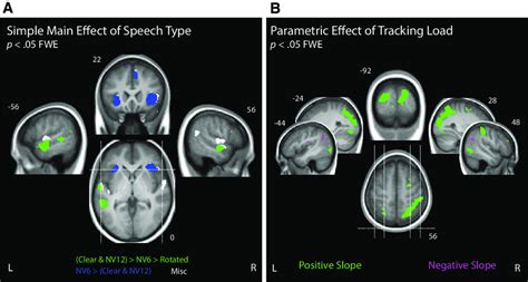 task specific simple main effects a simple main effect of speech