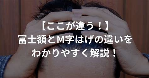 【ここが違う！】富士額とm字はげの違いをどこよりもわかりやすく解説！ Agaスマクリマガジン