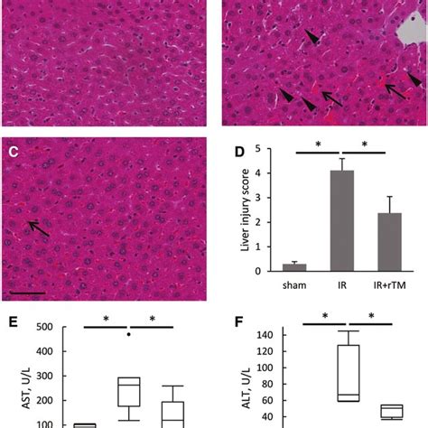 Survival Analysis Of A 45 Min Intestinal Ischemia Reperfusion Ir Download Scientific Diagram