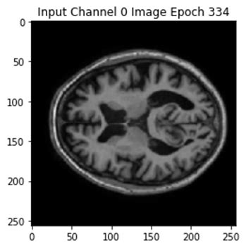 Github Leslie Zi Pan Wmh Segmentation Ipynb Brain White Matter Hyperintensity Segmentation