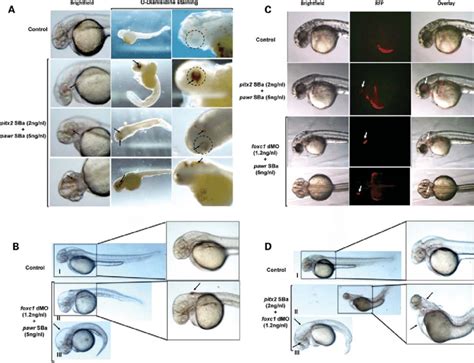 Genetic Interaction Between Foxc1 Pitx2 And Pawr In Zebrafish A