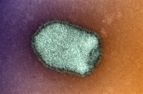 Two Major Types Of Rabies That Evolved In Different Ways Institut Pasteur