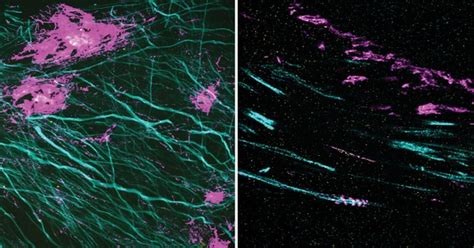 Innovative Microscopy Technology Unveils Mysteries Of Lipid Synthesis