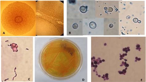 Mixed L Form Growth Of Bacteria And Yeasts And Isolation Of