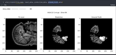 The Ultimate Guide To Nnu Net For State Of The Art Image Segmentation Towards Data Science